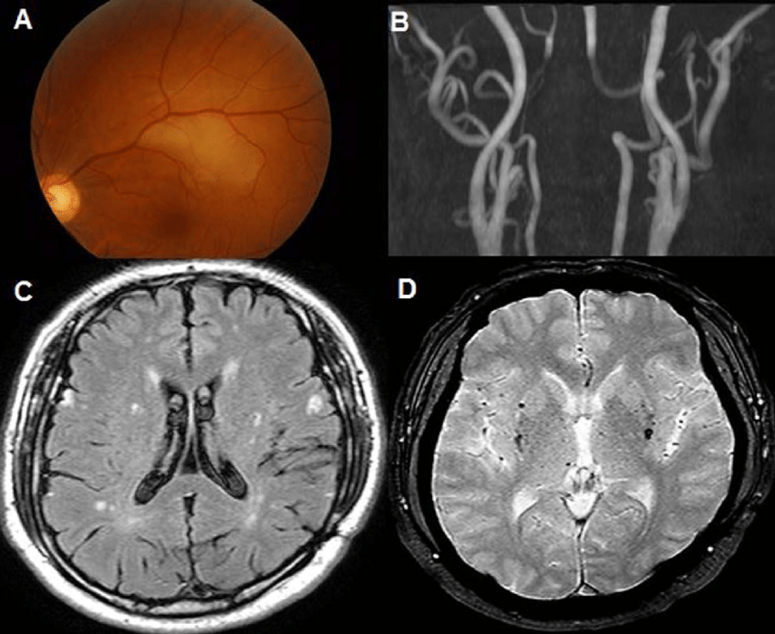 Data Annotation for Digital Radiology - iMerit
