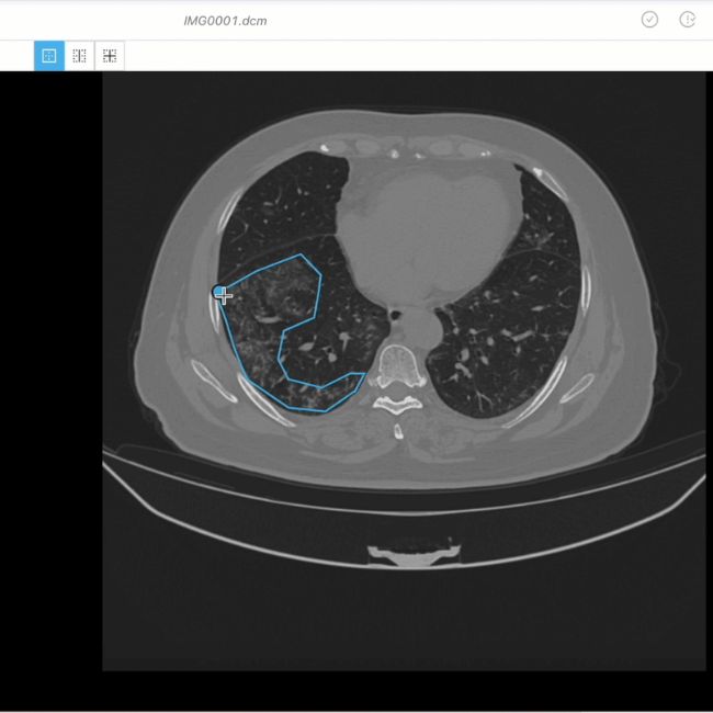 Medical Data Annotation And Common Use Cases In Digital Radiology Imerit