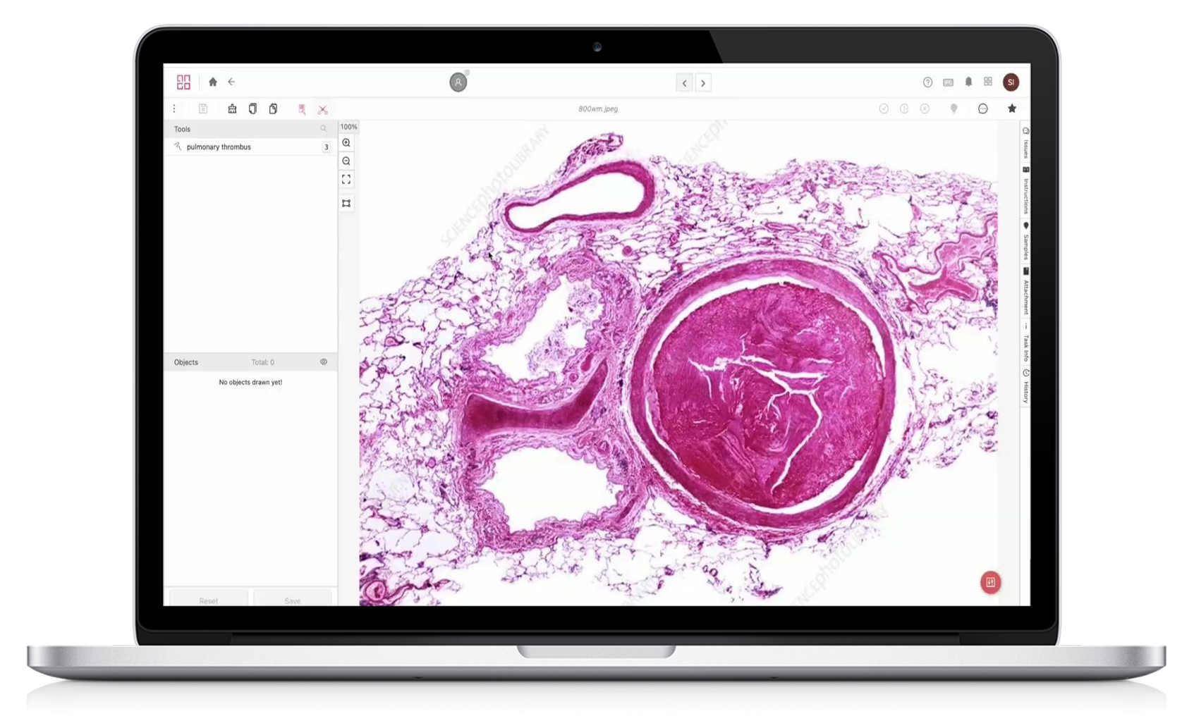 Data Annotation For Digital Pathology Imerit