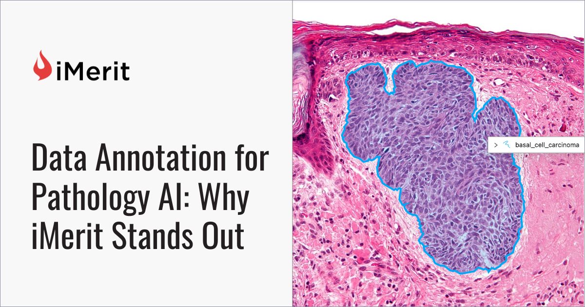 Data Annotation For Pathology Ai Why Imerit Stands Out Imerit