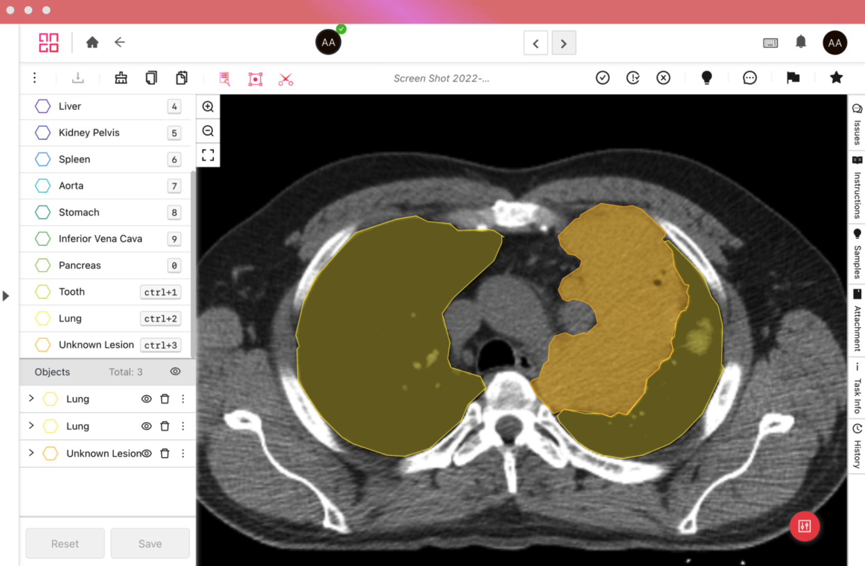 Medical Image Annotation: Techniques, Tools, and Best Practices