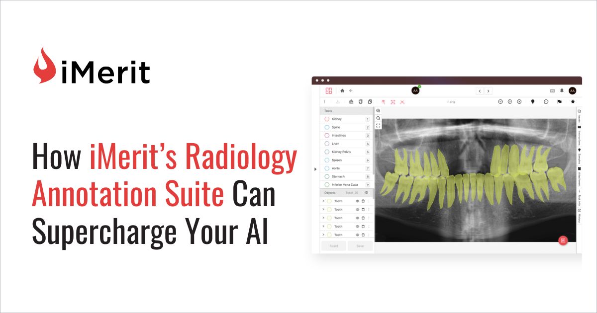 How the iMerit Radiology Annotation Product Suite Supercharges Medical ...