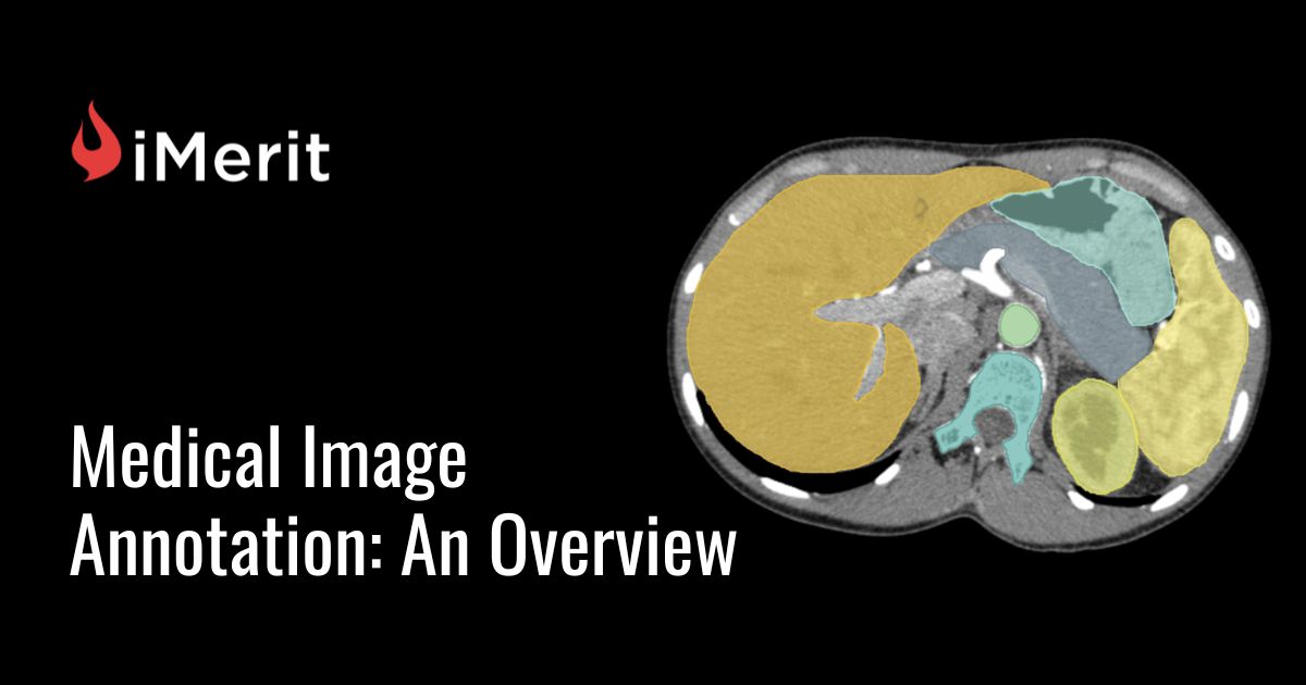 Medical Image Annotation Services at Amelia Rodrigues blog