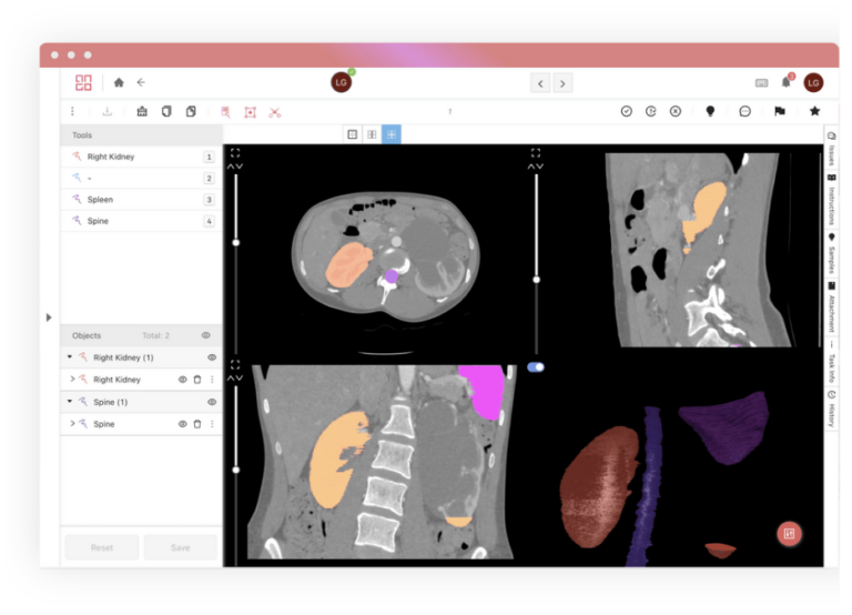 How the iMerit Radiology Annotation Product Suite Supercharges Medical ...