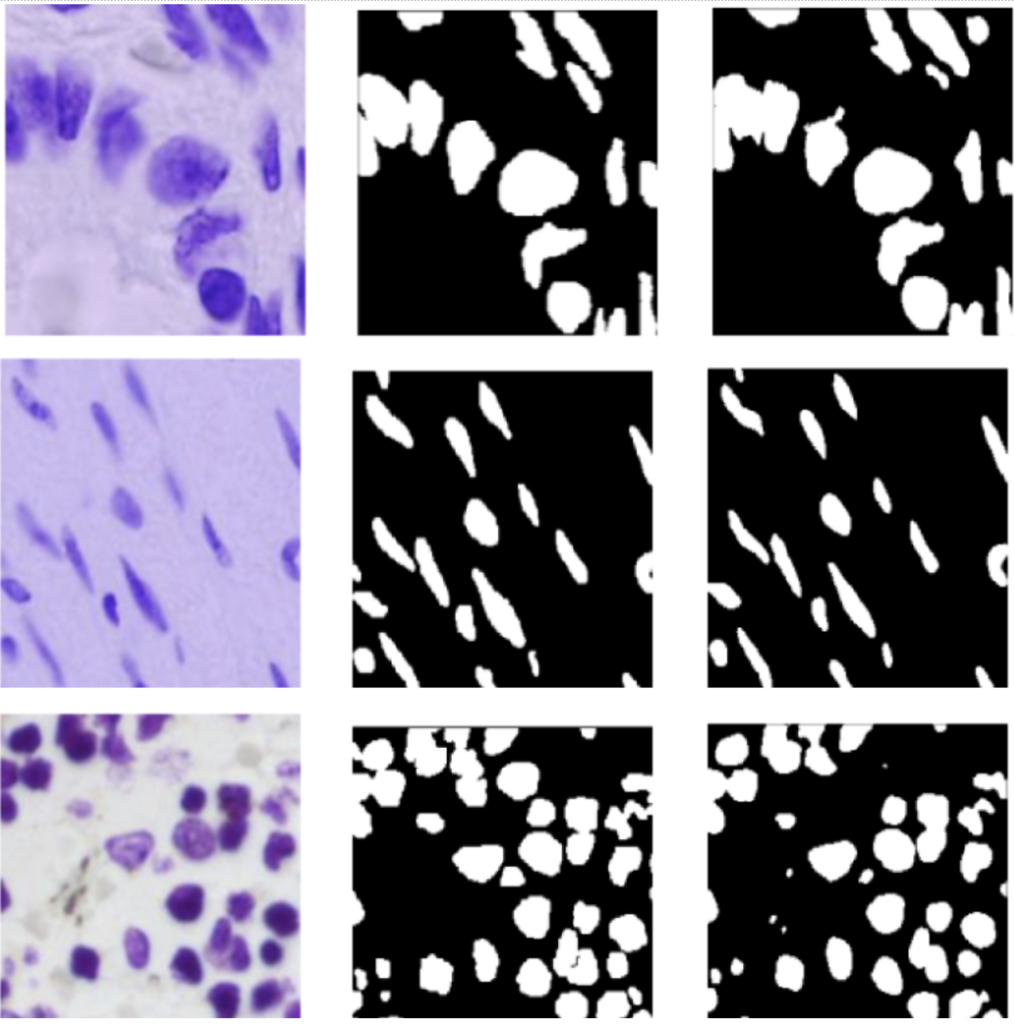 Medical Image Segmentation with iMerit Radiology Editor - iMerit