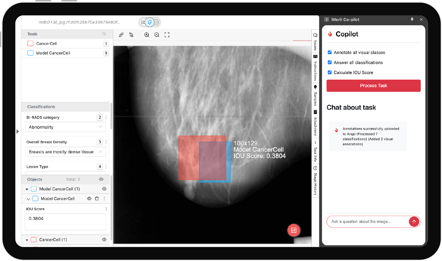 iMerit’s New Copilot for Radiology Accelerates and Simplifies Medical ...