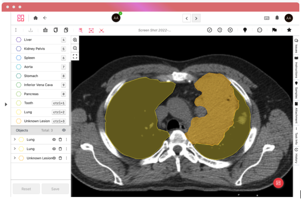 Medical Image Annotation: A Complete Guide for Healthcare AI